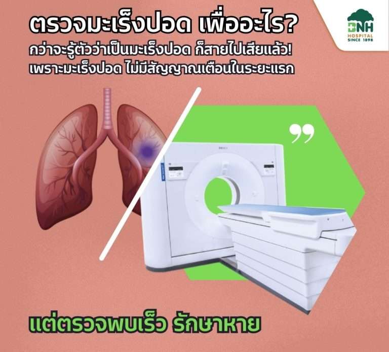 ตรวจคัดกรอง มะเร็งปอด อย่างแม่นยำด้วยเทคโนโลยี Spectral CT - BNH HOSPITAL