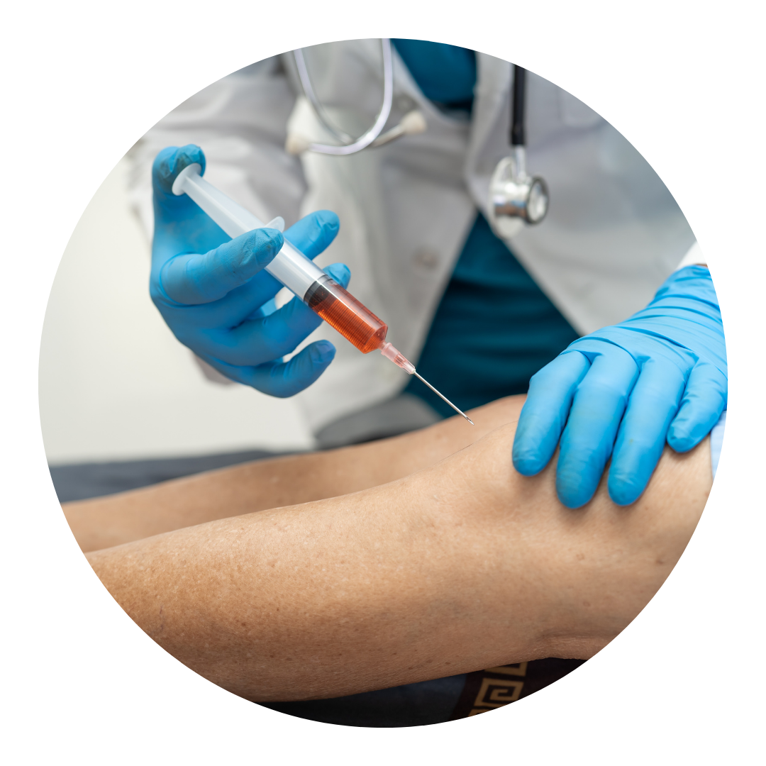 OA knee - BNH HOSPITAL