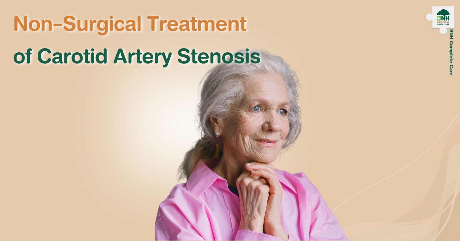 Non-Surgical Treatment of Carotid Artery Stenosis: A New, Safe, and ...