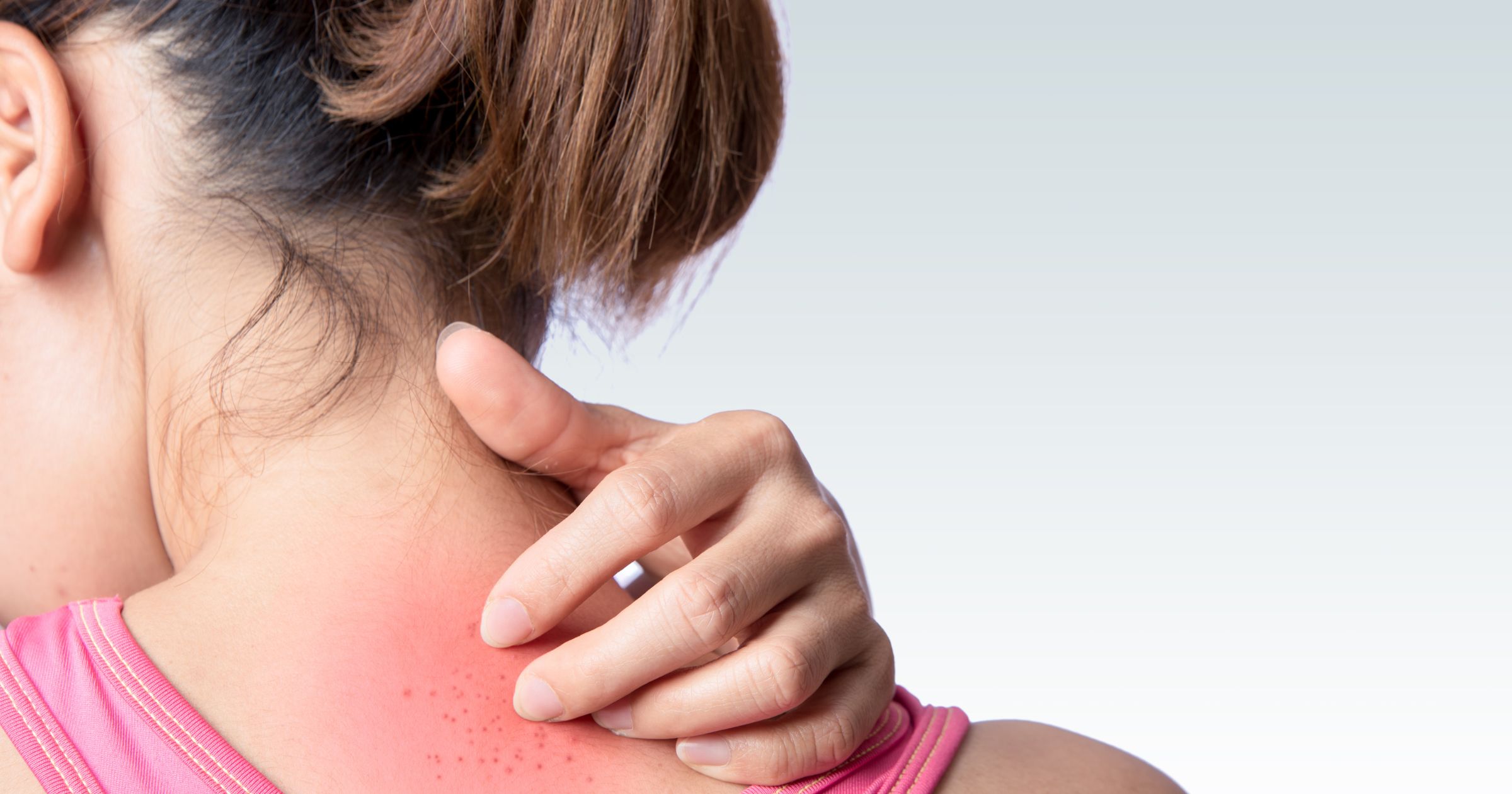 ALEX2 Allergy Explorer - BNH HOSPITAL